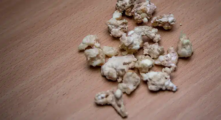 Why Crack Addiction So Devastating and How to Overcome It - Topsail ...